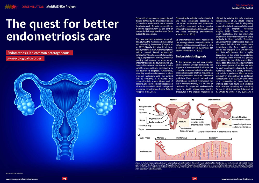 The quest for better endometriosis care » EDMA